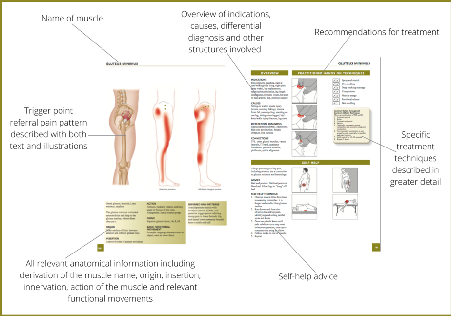 Trigger Points – free downloads for you - Think Tree Hub : Think Tree Hub