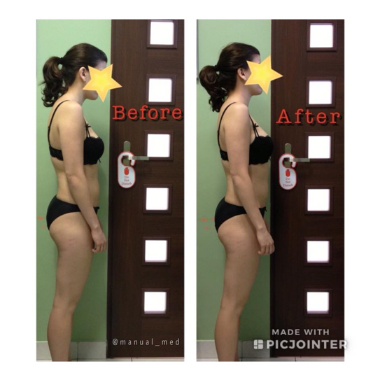 Interview - For the love of fascia - Think Tree Hub : Think Tree Hub